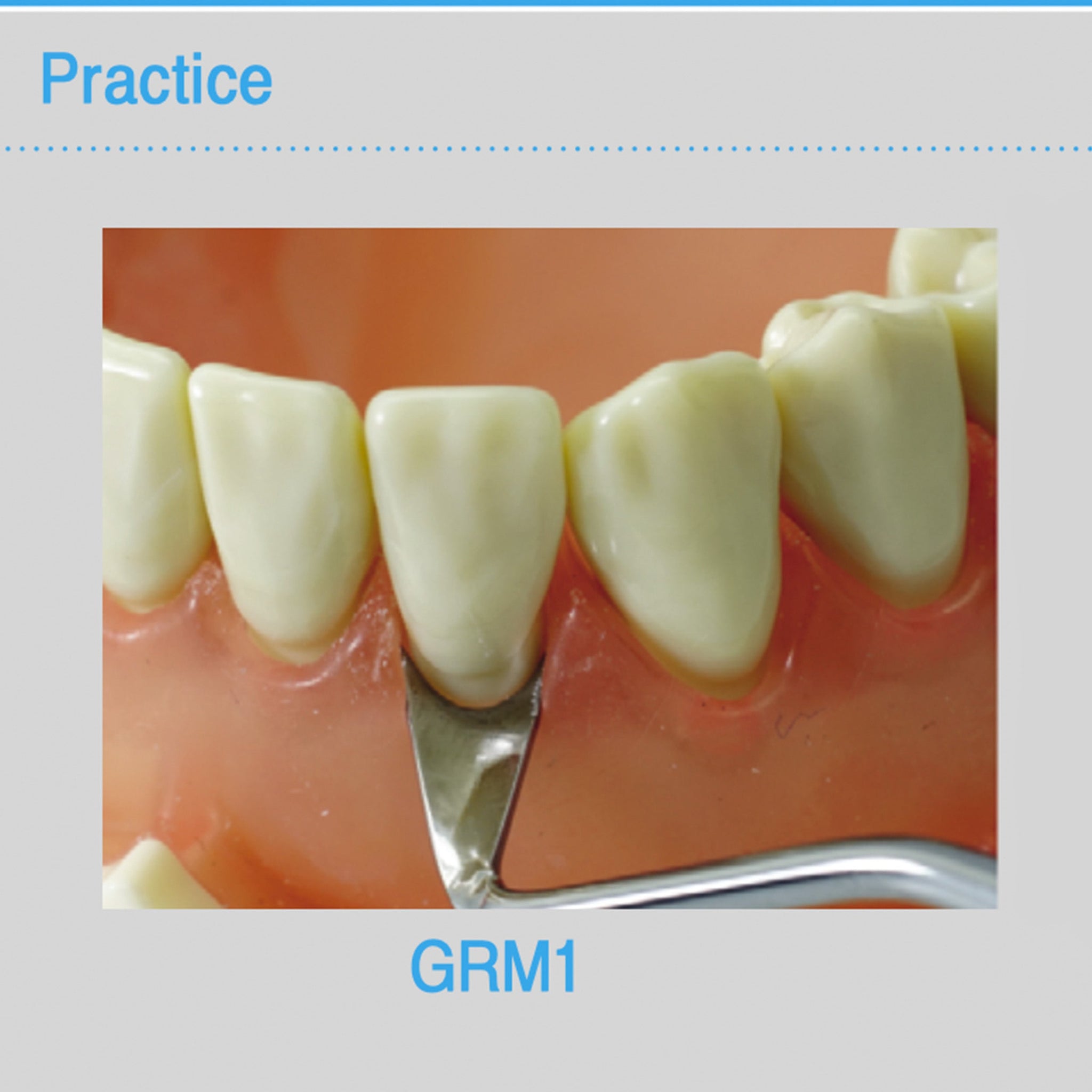 Osung #1 Gingival Retractor Lower incisors -GRM1 | Osung USA